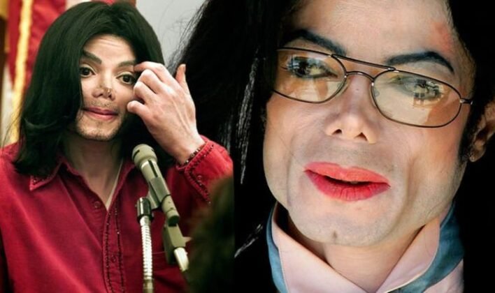 Michael Jackson Before and After: Plastic Surgery (King of Pop)